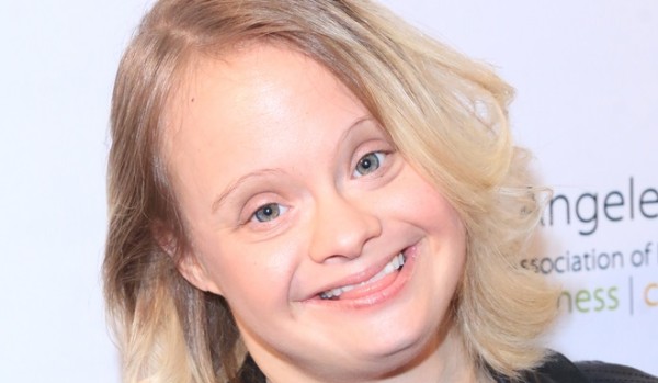 Zespól Downa | sameQuizy